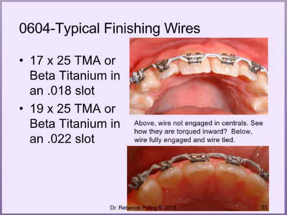60.41-Orthodontic Wire Basics Course - Product Details - OrthoTraining