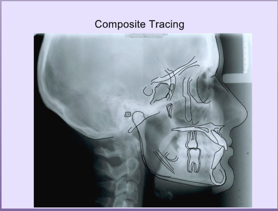 30.40-BASIC CEPHALOMETRICS-Imaging and Analysis - Product Details ...