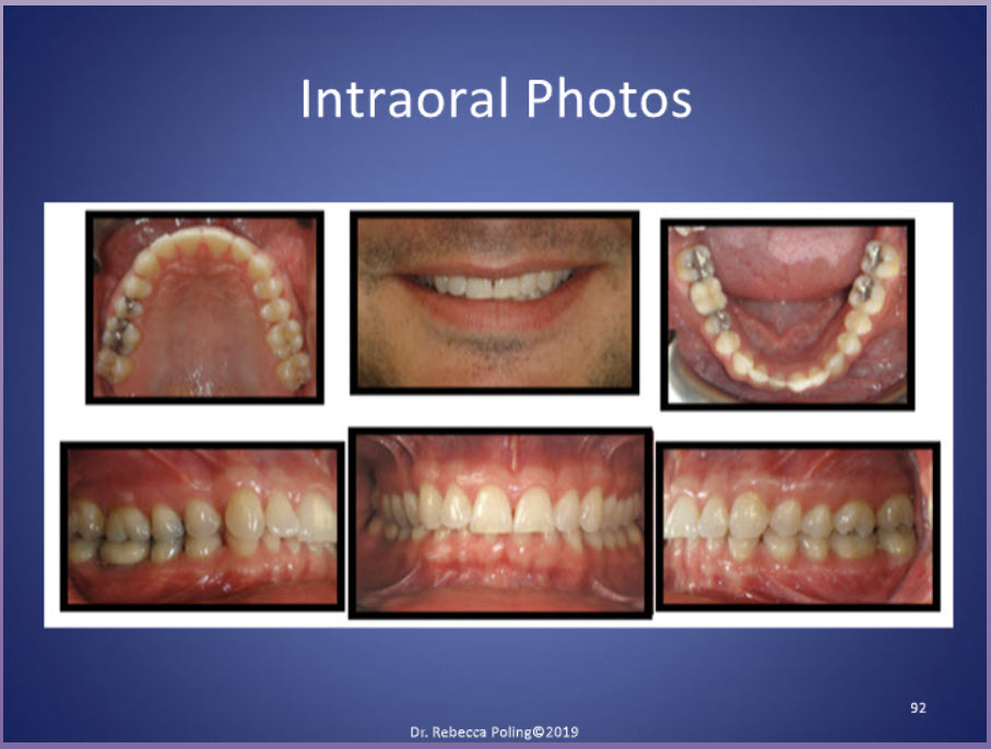 30.11-Producing an Orthodontic Photo Series - Product Details ...