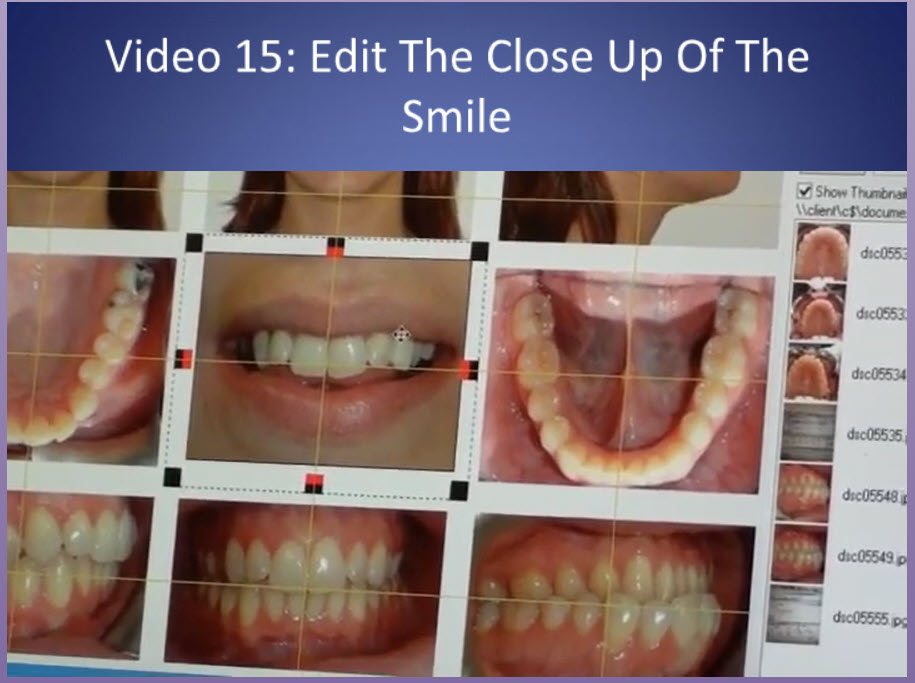 Orthodontic Basic Bundle of Courses - Product Details - OrthoTraining